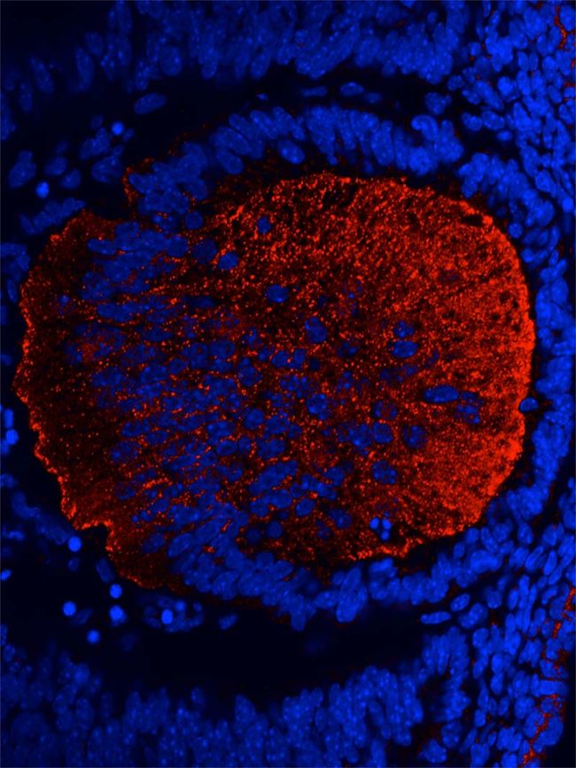 Magnificent Microphotography: 50 Tiny Wonders | Live Science