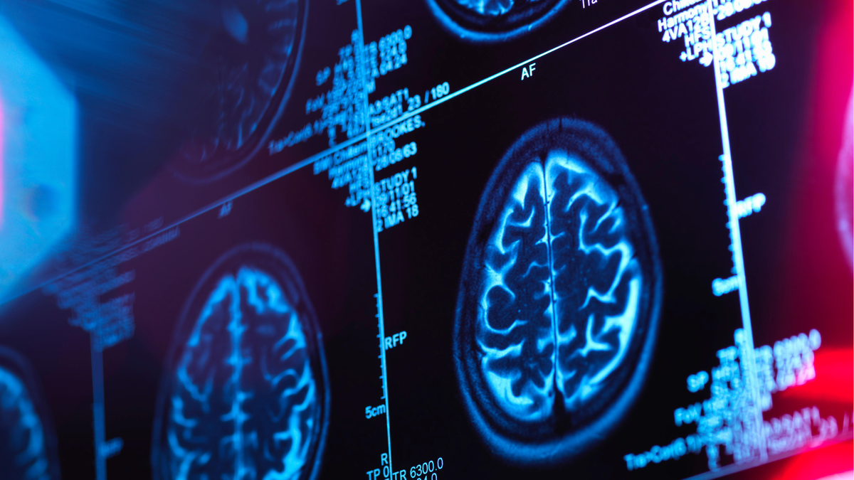 New Alzheimer's drug rejected: is Nice being nasty? | The Week
