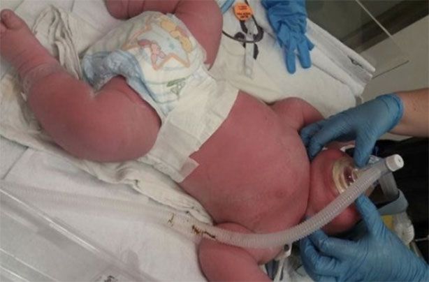 'We are not sure where his size comes from' Mum reveals 'shock' after ...