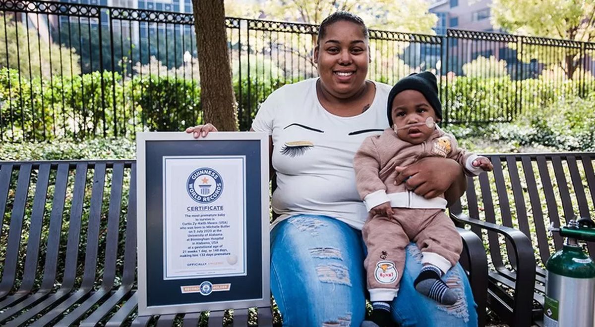 10 of the strangest pregnancies in the world | Live Science