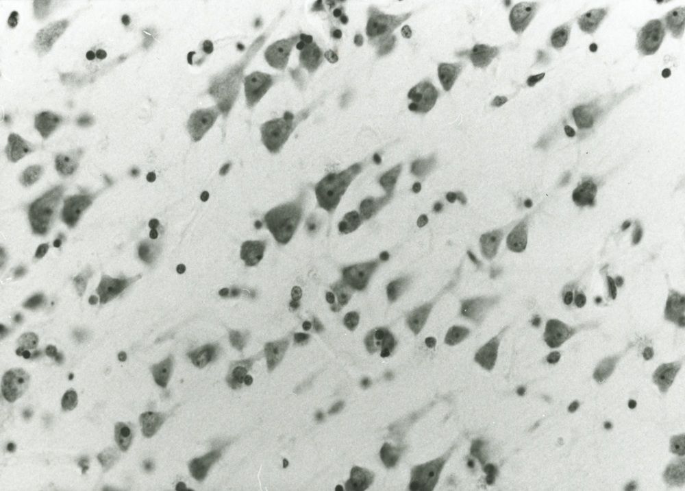 Pieces of Einstein's Brain Go On Display For First Time | Live Science