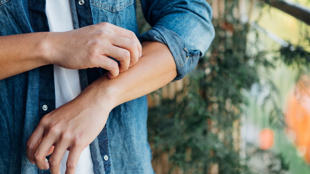 Allergy vs intolerance: What’s the difference? | Live Science