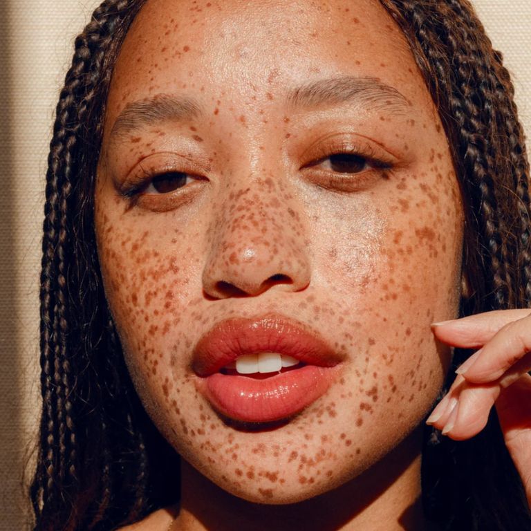 How to Treat and Fade Scars, According to Dermatologists | Marie Claire