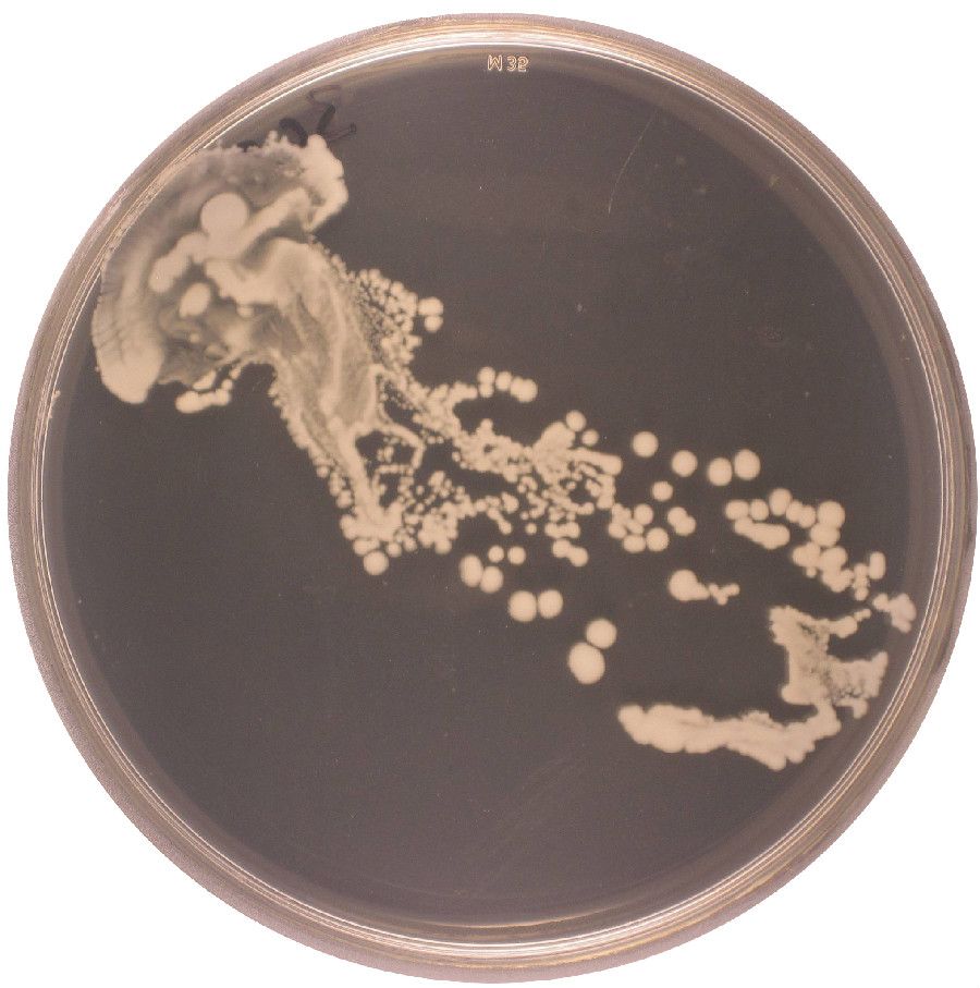 Gallery: Bacteria in Your Belly Button | Live Science