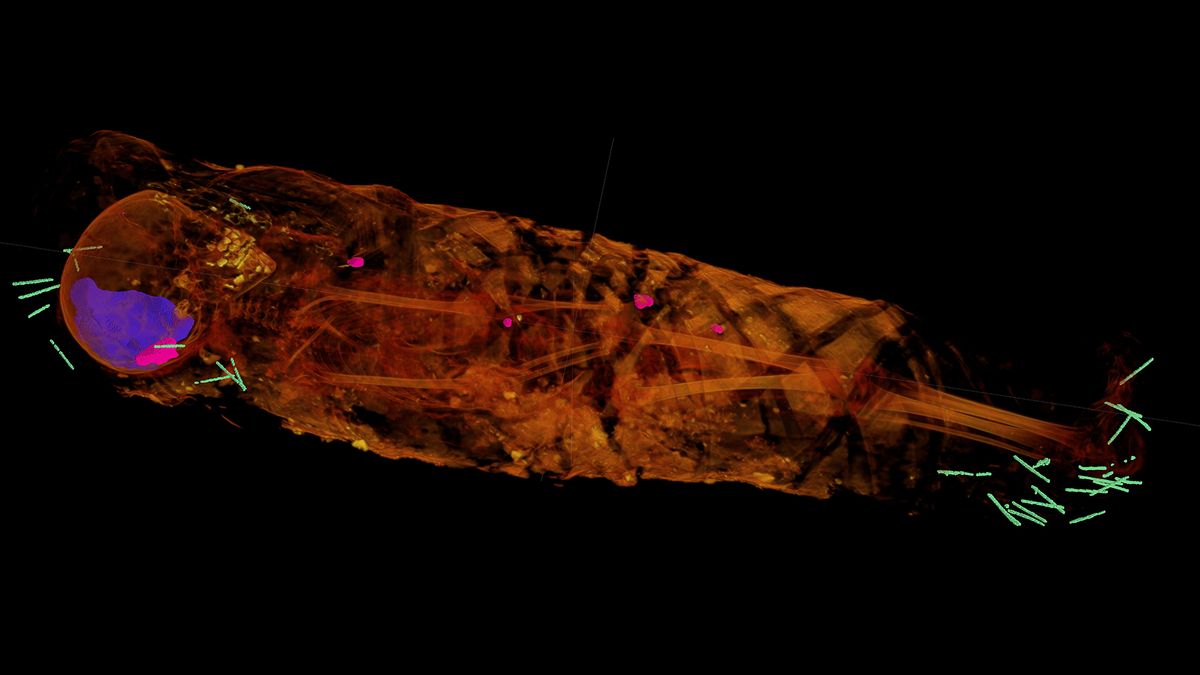 Roman-era Egyptian child mummy scanned with laser-like precision | Live ...