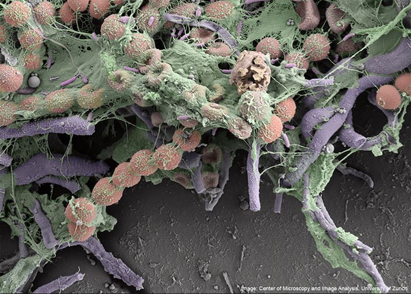 Here's What Growing Inside Your Rubber Ducky | Live Science