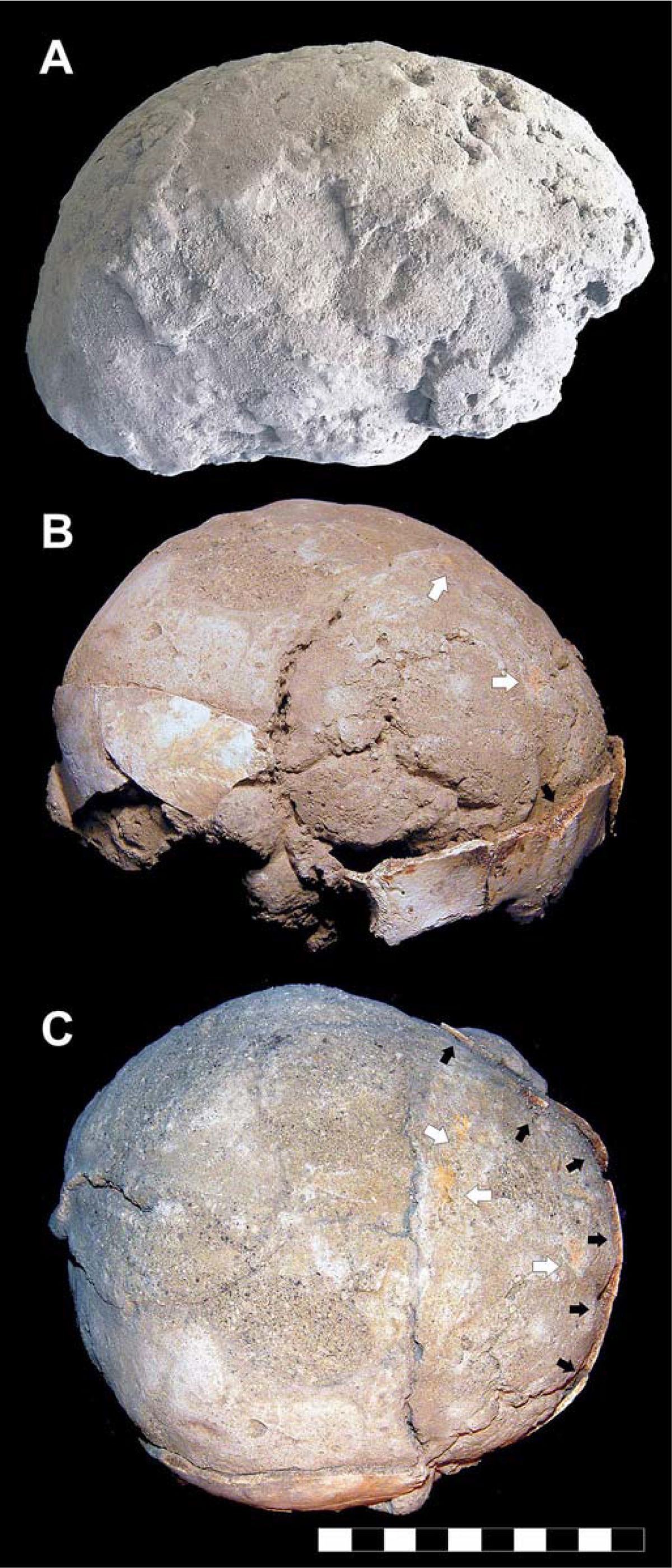 Photos: The Bones of Mount Vesuvius | Live Science