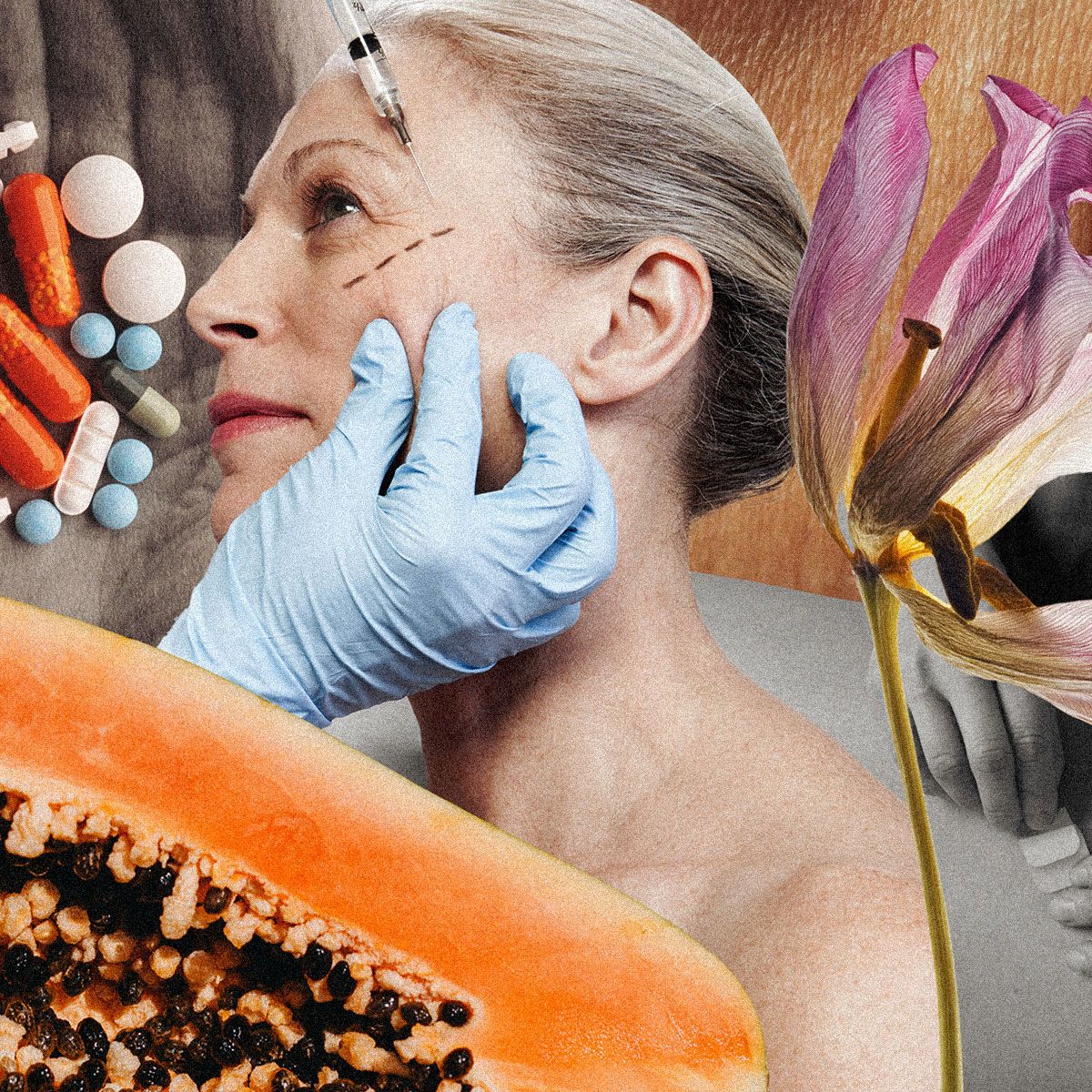 Platysmal Band Botox Is a Non-Invasive Way to Tighten the Jawline ...