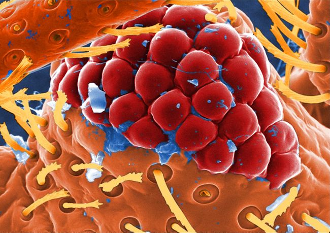 Tiny & nasty: Images of things that make us sick | Live Science