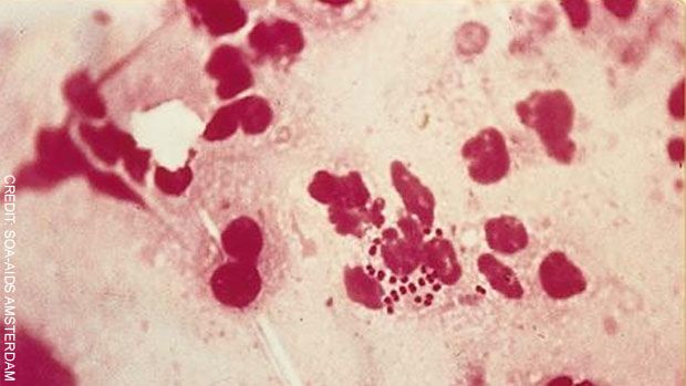 How to spot a fake STI test | The Week