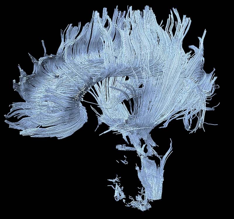 Inside the Brain: A Photo Journey Through Time | Live Science