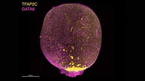 In a 1st, scientists grow human kidneys inside developing pig embryos ...