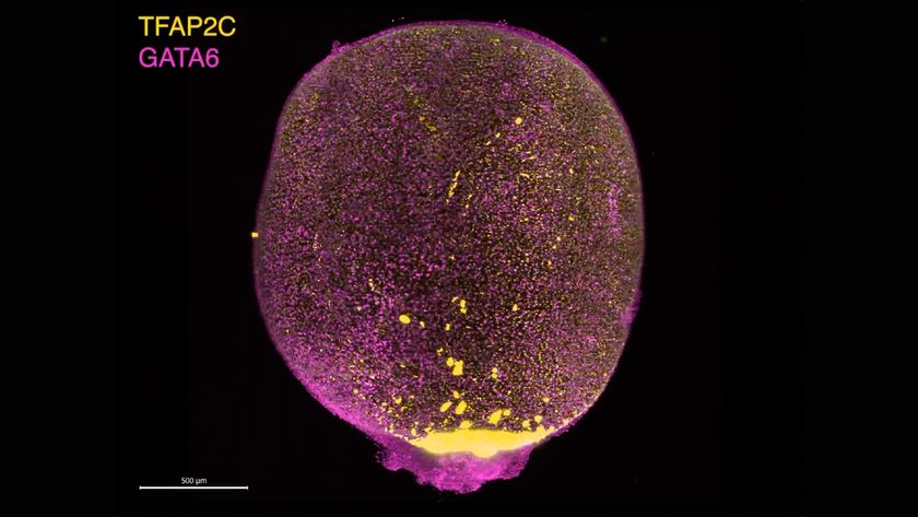 Lab-made mini brains grow their own sets of 'eyes' | Live Science