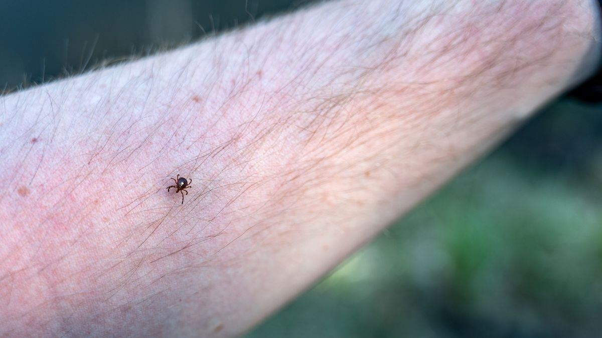 Alpha-gal syndrome causes uptick in meat allergies | The Week