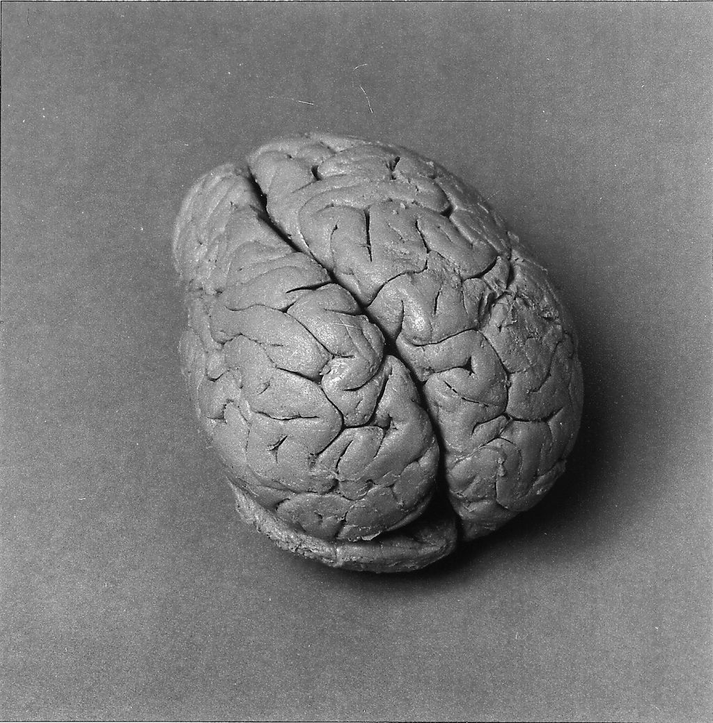 Identity of Famous 19th-Century Brain Discovered | Live Science