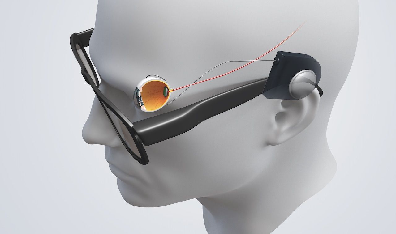 Bionic eyes:How tech is replacing lost vision | Live Science