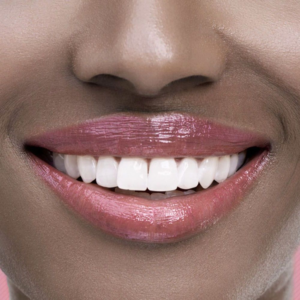 Lip Glosses That Make Teeth Whiter - How to Make Teeth Look Whiter ...
