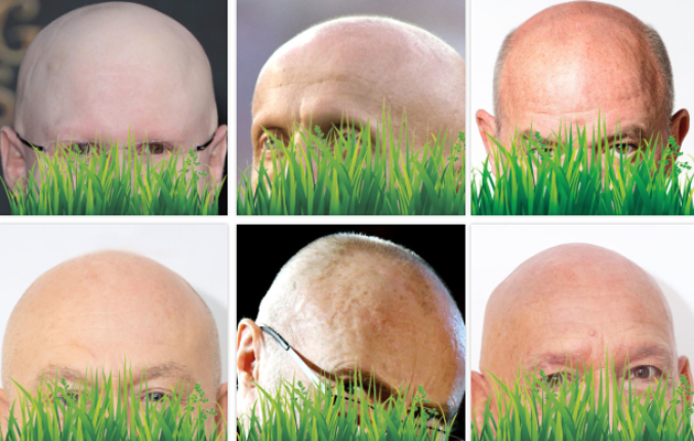 Easter egghead hunt! How many bald celebrities can you name? | What to ...