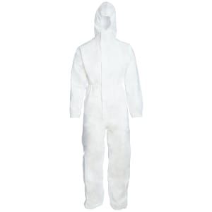 Artex ceilings: What is Artex and how do you get rid of it? | Homebuilding