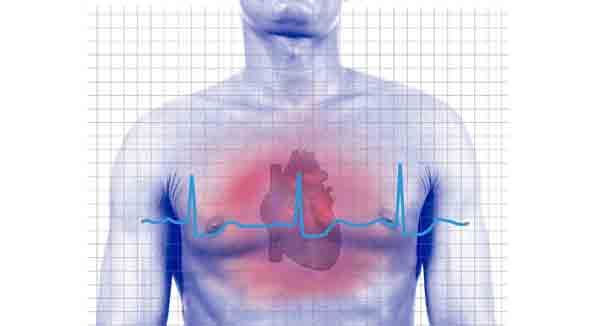 Far from the Heart, Watch for Peripheral Artery Disease (Op-Ed) | Live ...