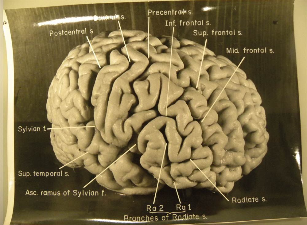 Image Gallery: Einstein's Brain | Live Science