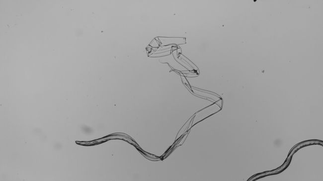 'American Murderer' Worm Strips To Evade Your Immune System | Live Science