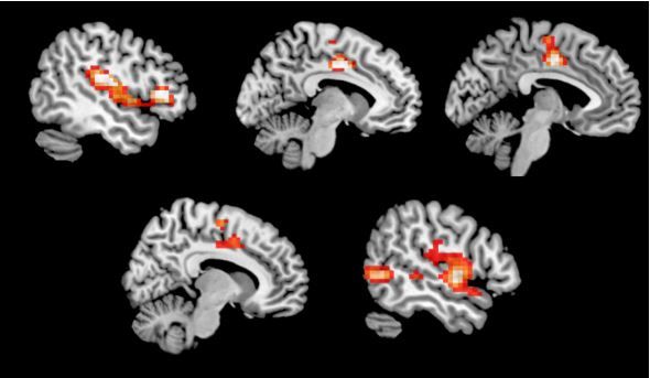 MDMA Makes People More Cooperative... But That Doesn't Mean More ...