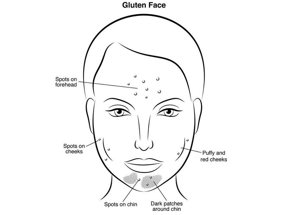 Sugar Face: What Eating A Heavy Sugar Diet Is Doing To Your Skin ...