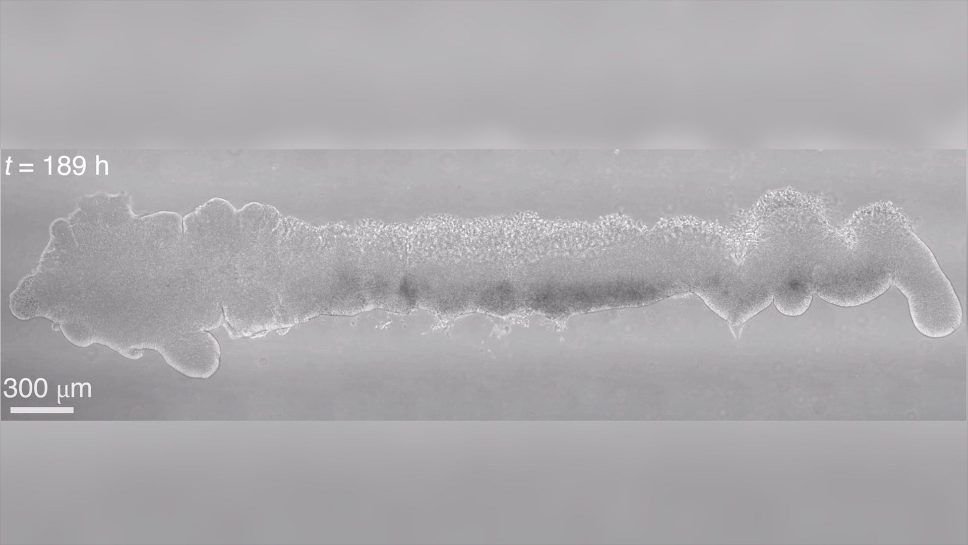 Mini model of human embryonic brain and spinal cord grown in lab | Live ...