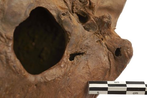 In Images: Skulls of Roman Gladiators and War Captives | Live Science