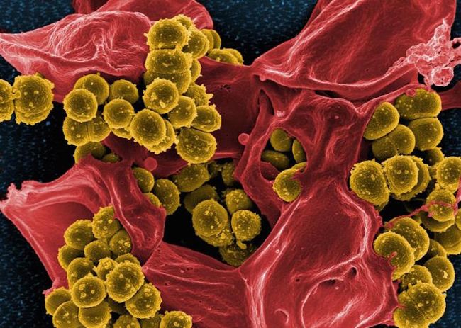 28 Devastating Infectious Diseases | Live Science
