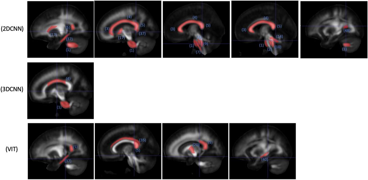 Is there really a difference between male and female brains? Emerging ...