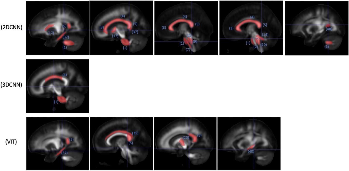 Is there really a difference between male and female brains? Emerging ...