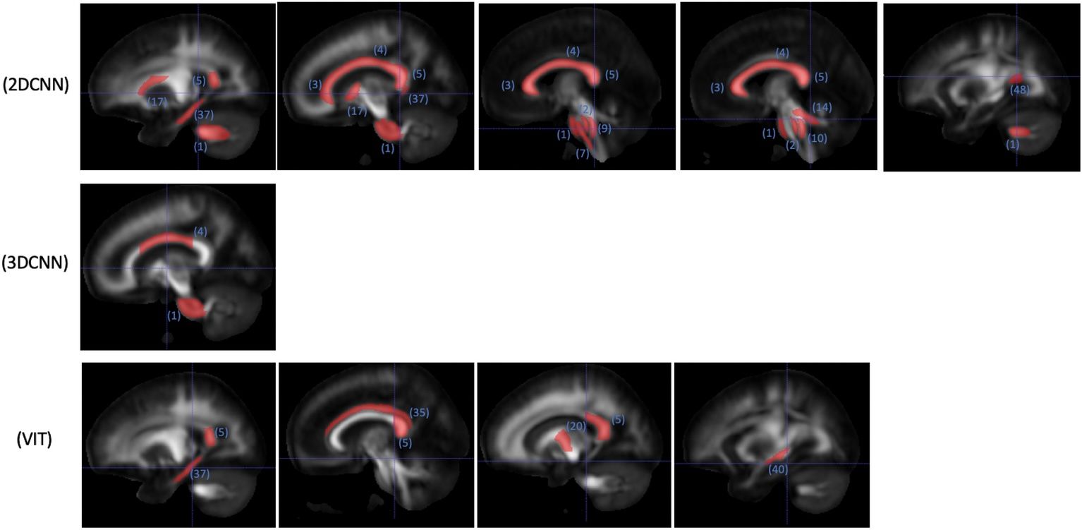 Is there really a difference between male and female brains? Emerging ...