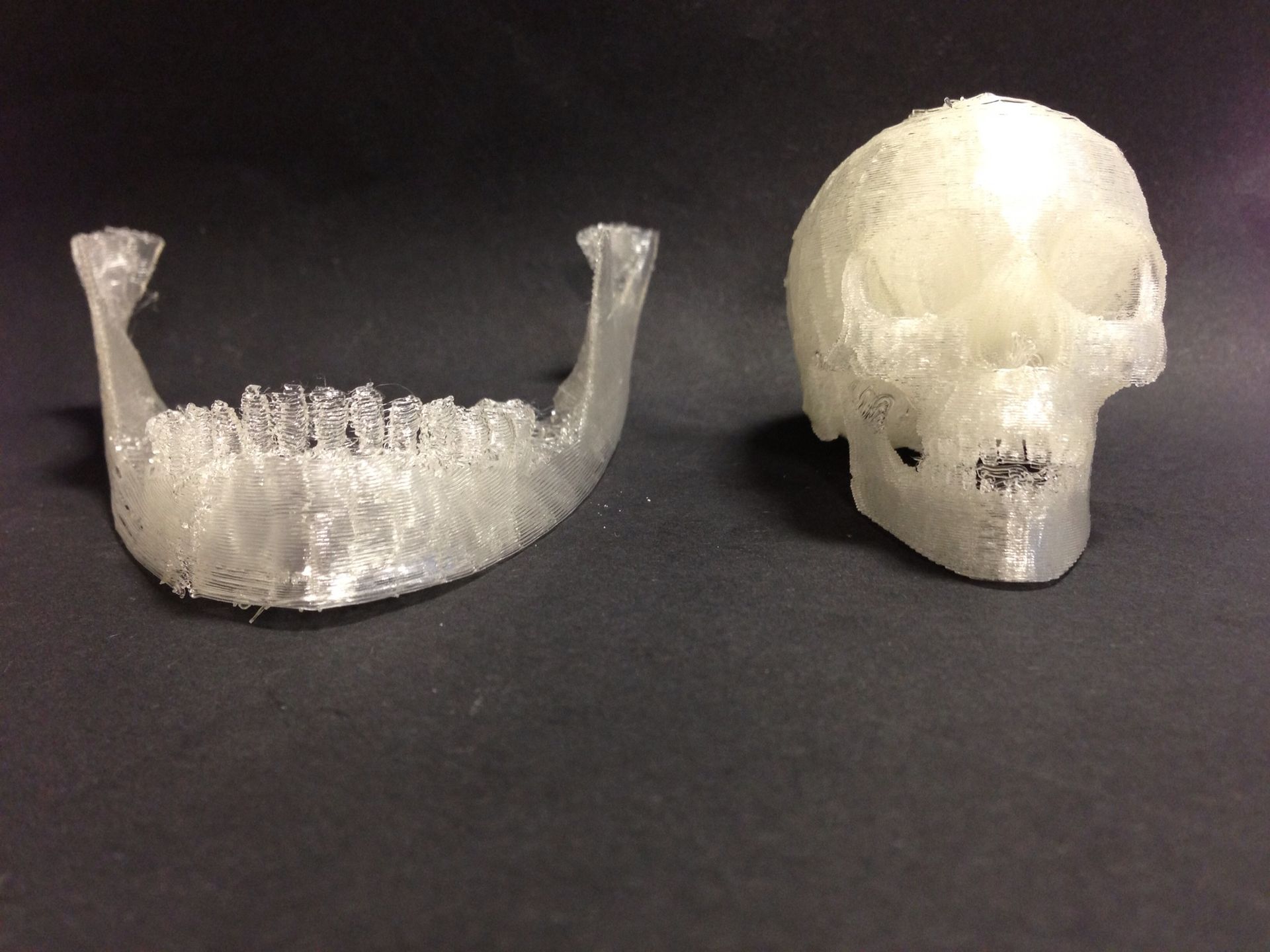 3D Printing Stem Cells to Build Bone | Tissue Engineering | Live Science