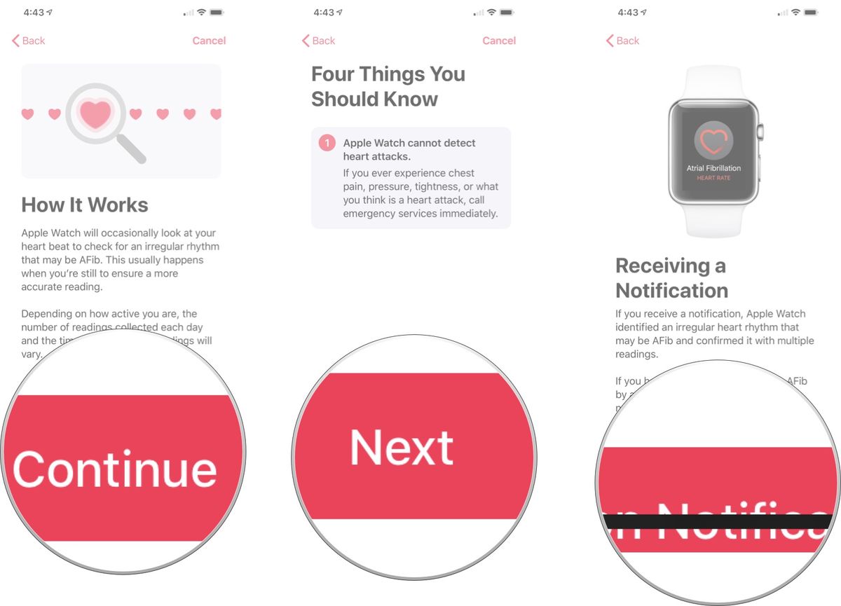 ECG Apple Watch App: The Ultimate Guide | iMore