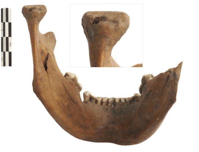 In Images: Skulls of Roman Gladiators and War Captives | Live Science