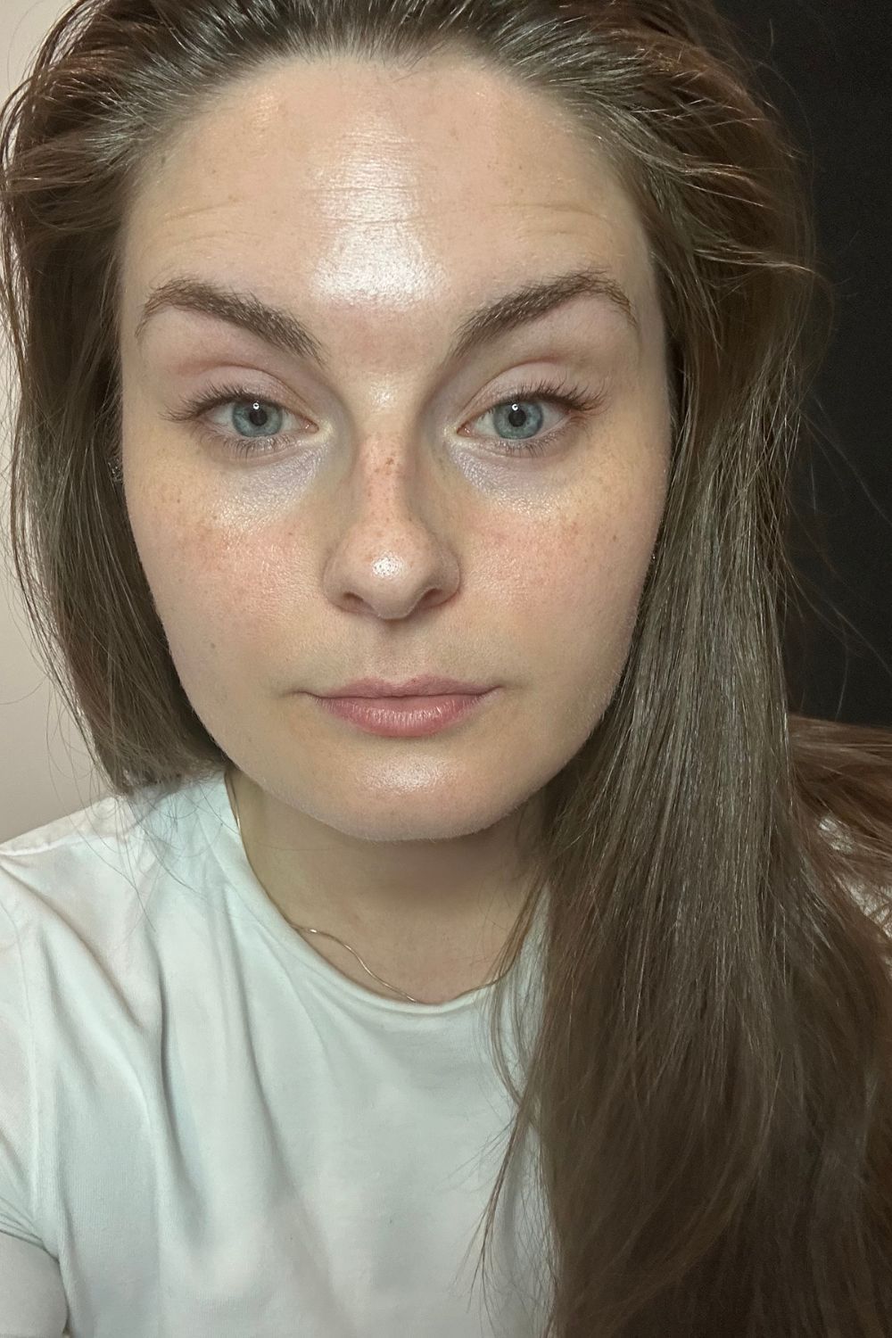 BBL Treatment, Reviewed By A Redness-Prone Editor | Marie Claire UK