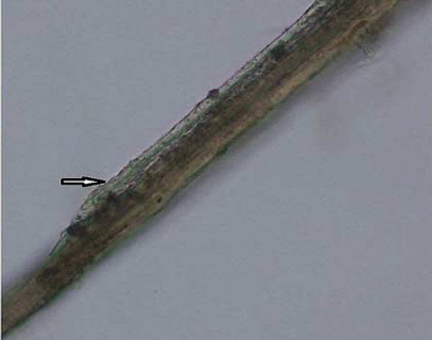 Worm in the Eye! Creepy Crawly Removed in Odd Case | Live Science