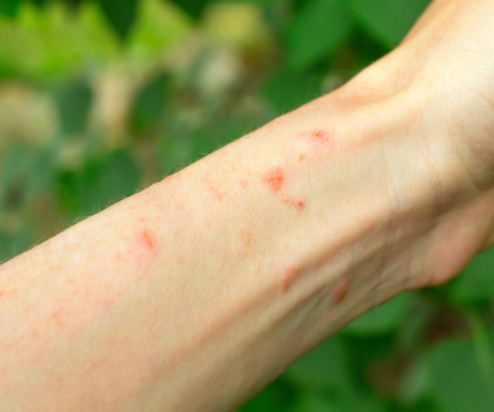 How To Identify Poison Ivy To Prevent A Painful Rash | Gardening Know How