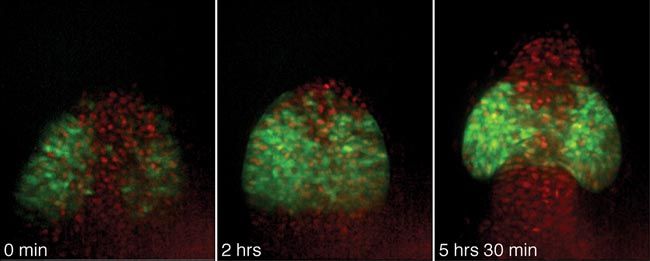 New Insight into How Eyes Form in Embryos | Live Science