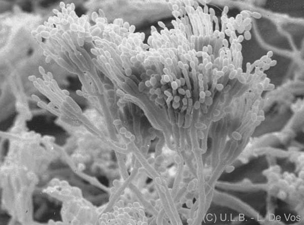 Microscopic Worlds Gallery: Fascinating Fungi: Page 2 | Live Science