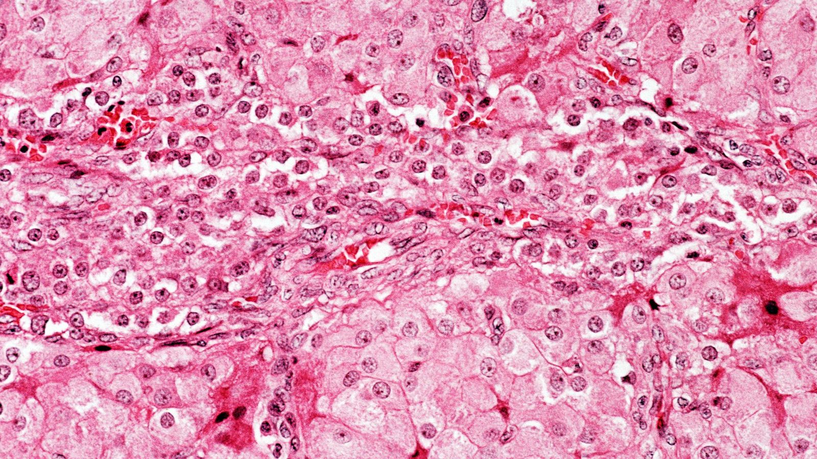 What to Know if You Suspect You Have PCOS | Marie Claire