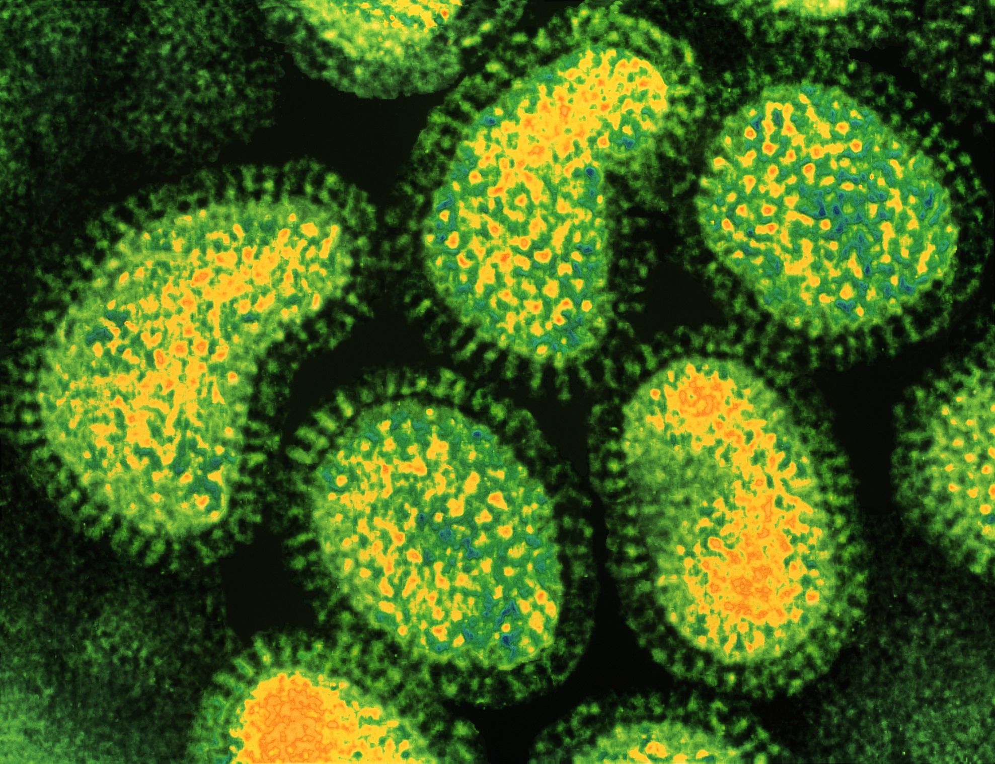 A New Flu Drug Was Just Approved by the FDA. It's the First in Nearly ...