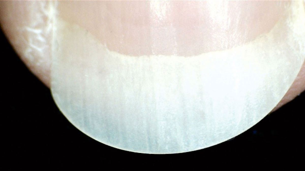 How your fingernails can improve your acoustic guitar tone | MusicRadar