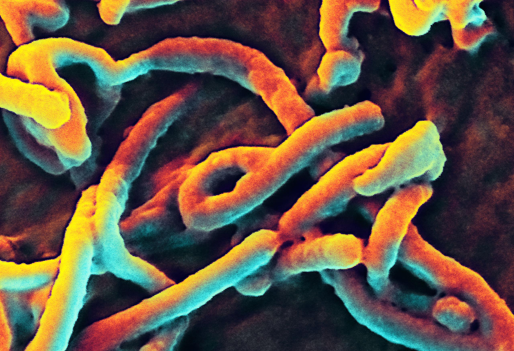 2014 Ebola Outbreak: Ongoing Coverage of the Viral Epidemic | Live Science