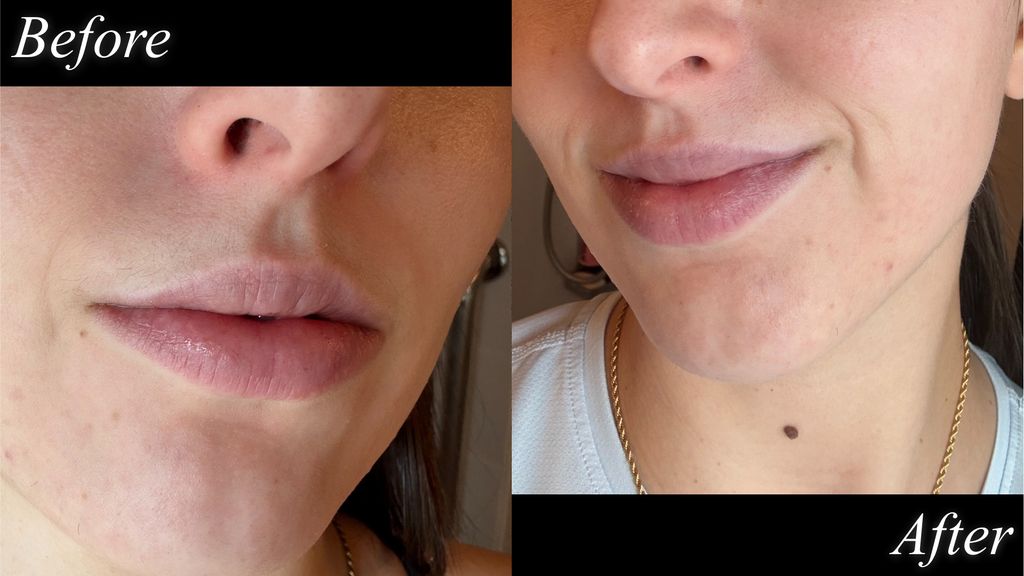 12 Best Dermaplaning Tools for 2025, Tested by Editors | Marie Claire