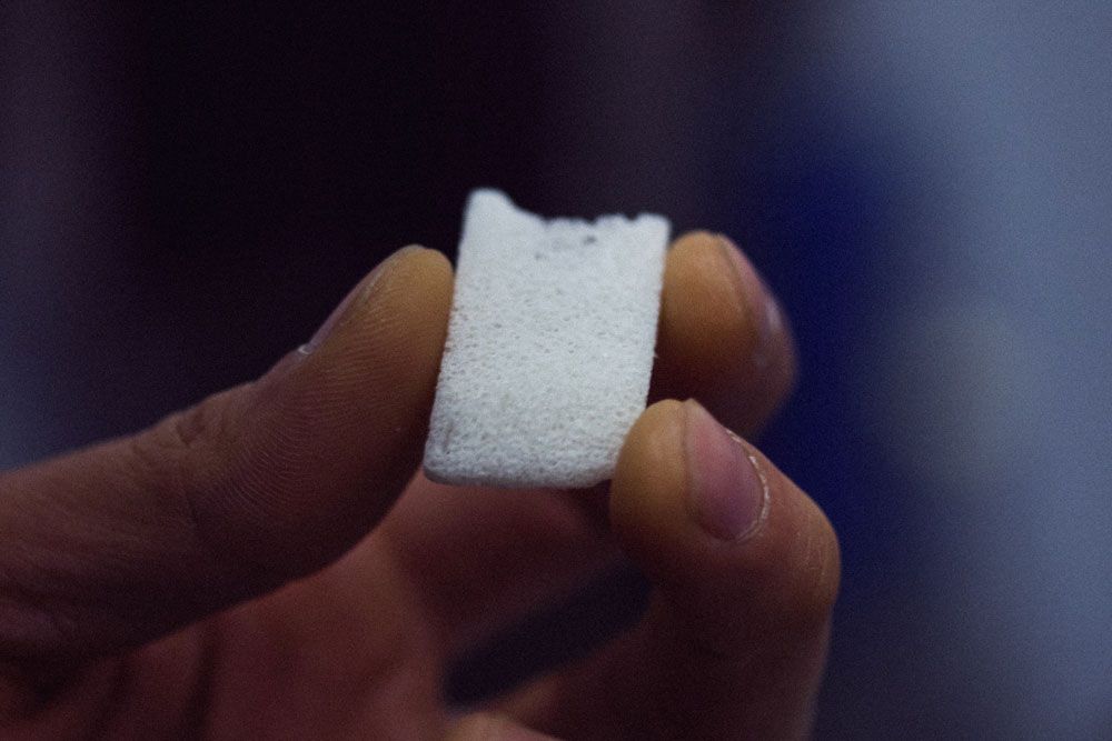 Lab-Grown Bones? They Could Make Painful Grafts History | Live Science