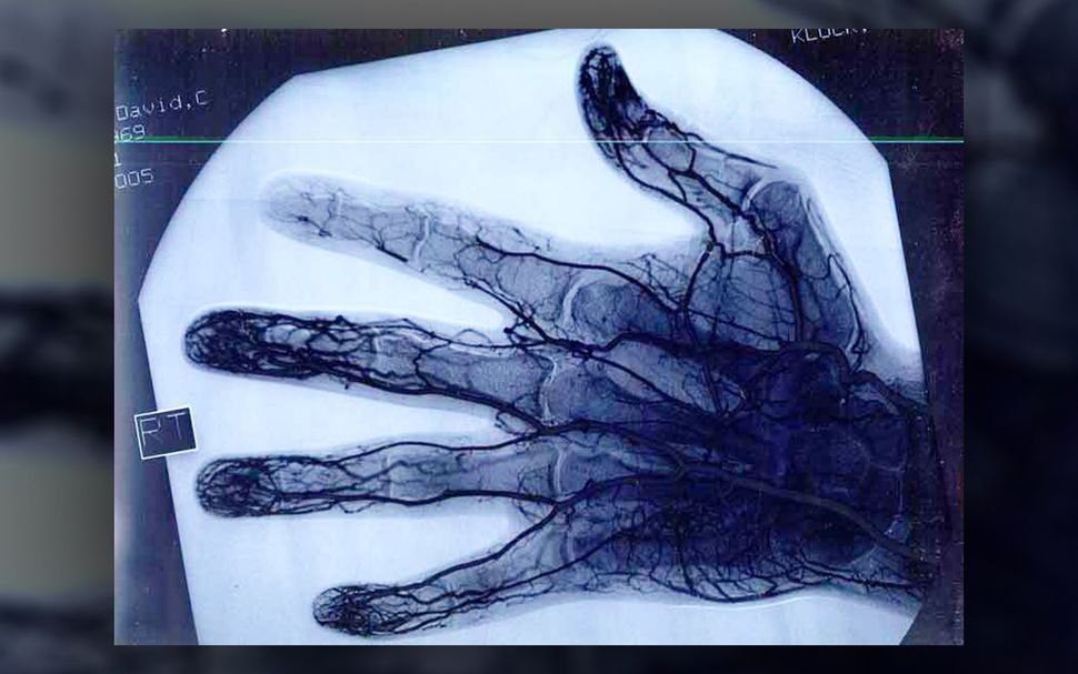 What the Heck Happened to This Yo-Yo Champ's Index Finger? | Live Science