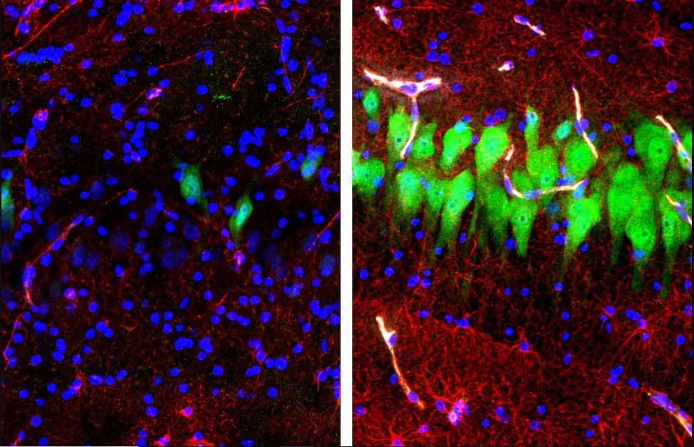 Hours After Pigs' Death, Scientists Restore Brain Cell Activity | Live ...